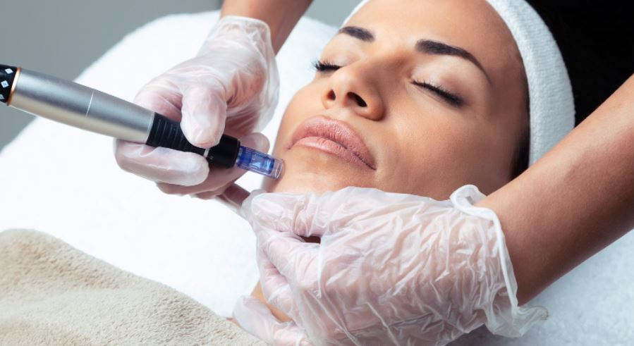 UNVEILING THE DERMAPEN PROCEDURE: A NON-SURGICAL PATH TO RADIANT SKIN ...